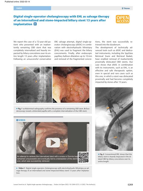 Pdf Digital Single Operator Cholangioscopy With Ehl As Salvage