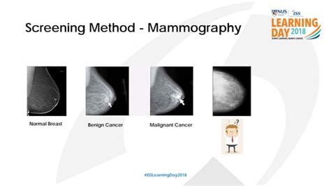 Nus Iss Learning Day 2018 Abnormality Classification Using Convolutional Neural Networks On