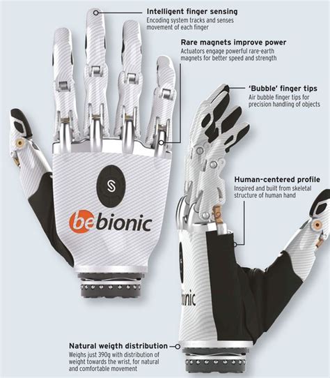 Revolutionary £1m Bionic Hand Allows One Armed Woman To Perform