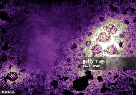 Dane Particles Photos And Premium High Res Pictures Getty Images