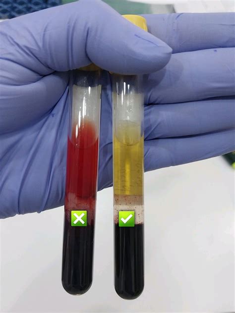 Julie Friedman Md Posted On Linkedin