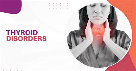 Thyroid Disorders Dr Bathija