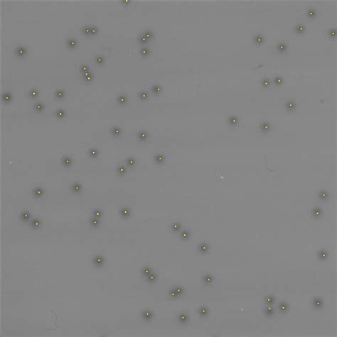 Image Processing Identifying And Counting Closely Spaced Particles