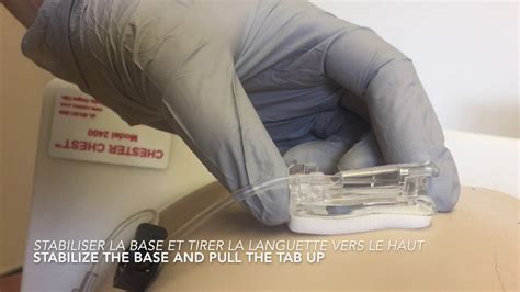 How To Remove Gripper Rods At Thomas Pritchett Blog