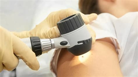 Mole Mapping Elite Medical Centre