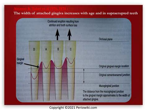 Attached Gingiva And Procedures For Gingival Augmentation Pptx