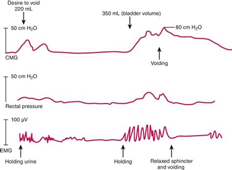 137 Neurogenic Bladder Clinical Gate