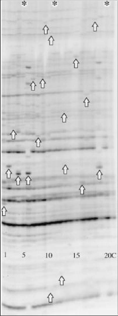 Autoradiography Of The Ref The Labeled Pcr Fragments From Colonies Download Scientific Diagram