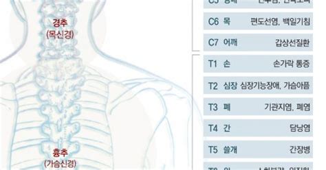 척추불균형은 만병의 근원 척추가 바로 서야 몸이 편안합니다