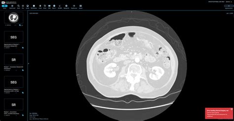 error message in the ohif viewer support imaging data commons