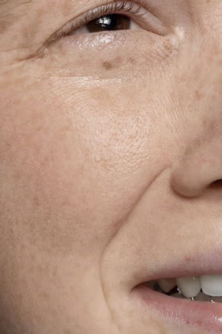 Wrinkle Object Detection Dataset By Project