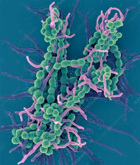 Scopulariopsis Brevicaulis Hyphae And Spores Sem Stock Image C032 3104 Science Photo Library