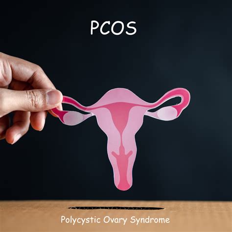 Pcos Screening Chemhealth Diagnostics Pcos Screening Chemhealth Diagnostics