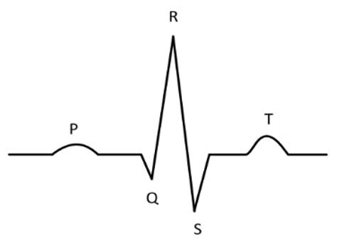 Atrial Fibrillation Detection With Single Lead Electrocardiogram Based On Temporal Convolutional
