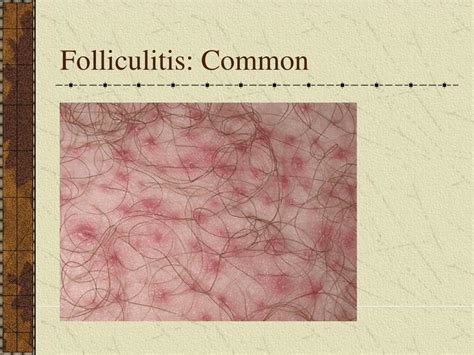Ppt Dermatology Primer Powerpoint Presentation Free Download Id141906