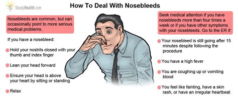 Nosebleeds Are Relatively Common And Not Usually A Reason To Panic When Should You Seek