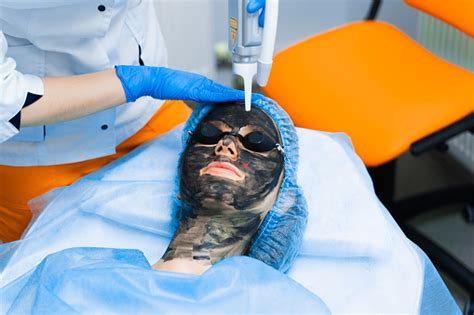 레이저 광전도 및 여성을위한 얼굴의 탄소 박리 검은 얼굴 마스크 피부과 및 미용학 수술 레이저를 사용 하 여 가꿔주기에 대한 스톡 사진 및 기타 이미지 Istock