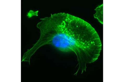 wave regulatory complex play key role in cytoskeletal remodeling