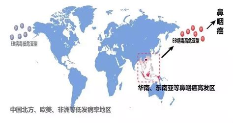 自然遗传发表重要进展中肿与合作伙伴共同发现鼻咽癌EB病毒高危亚型 搜狐大视野 搜狐新闻