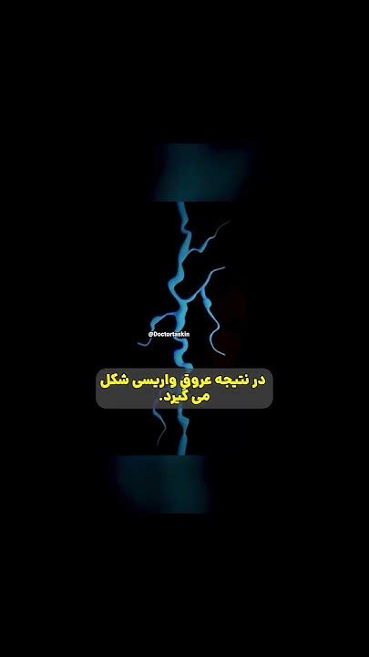 اسکلروتراپی روش درمانی برای درمان ورید های عنکبوتی و وریدهای واریسی کوچک است Youtube