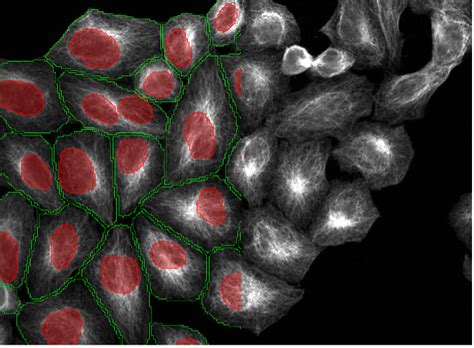 20 Examples Of Effortless Nucleus And Cell Segmentation Using Pretrained Deep Learning Models