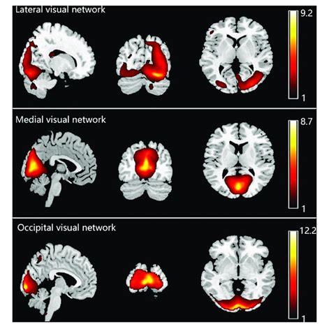 Negative Correlation Between Functional Connectivity Within The Download Scientific Diagram