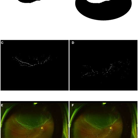 Image Process Of Rrd And Non Rrd Group With Personality Cover A Download Scientific Diagram