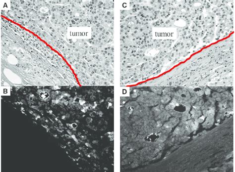 Fluorescent Microscopy In Two Cases With Positive Fluorescence In The Download Scientific