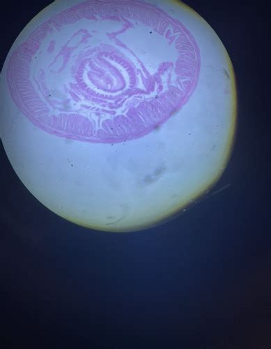 Platyheminthes And Nematode Test Flashcards Quizlet