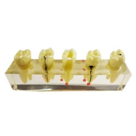 Root Canal Model For Dentistry At ₹ 1700piece In Mumbai Id 20570044988