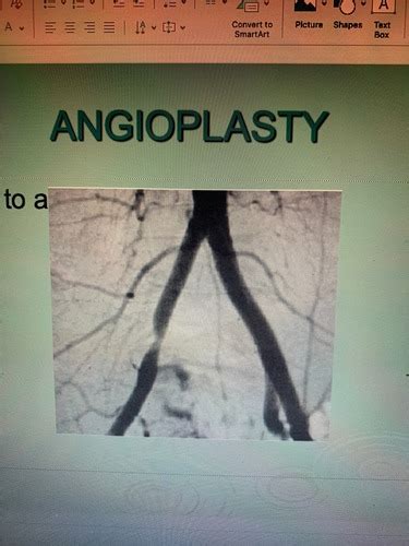 Dsa Anatomy Flashcards Quizlet