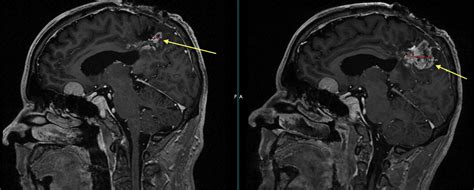 Round Two Depth First