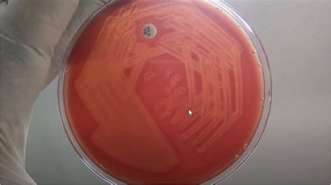 L Pyrrolidinyl β Naphthylamide Pyr Test Introduction Principle