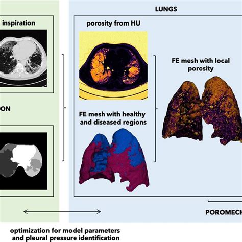 schematic representation of the personalized lung modeling pipeline