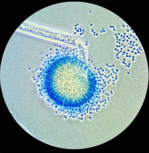 Phase Contrast Microscopy For Aspergillus Niger At 1000x Saloumeh Esmaeilzadeh Posted On The