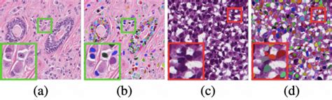 Panoptic Segmentation Enables Real World Computer Vision In Healthcare Industries Open Datasets