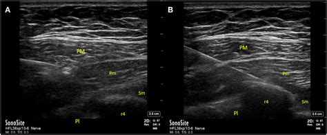 Ultrasound Image With Identification Of Relevant Structures For Download Scientific Diagram