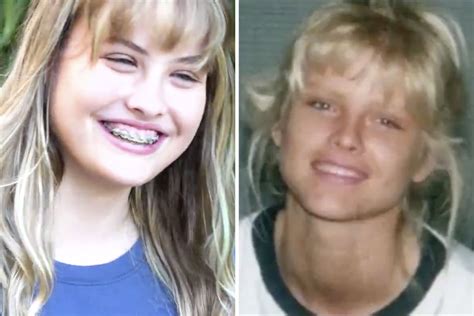 Anna Nicole Smith Daughter Eye Problem