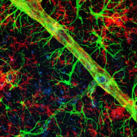 Laboratory Of Neurovascular Interactions Director Dr Ayman Elali Phd