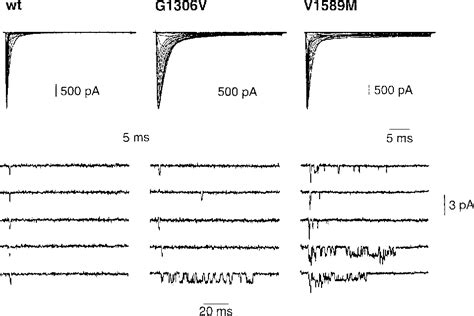 Malignant Hyperpyrexia Due To Anesthesia Semantic Scholar