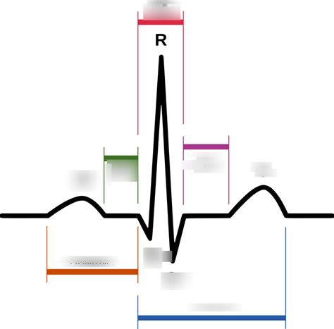 Ecg Leads And Waveform Diagram Quizlet