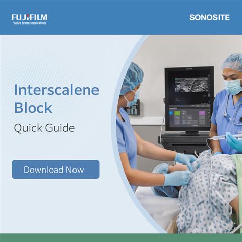 Get Your Interscalene Block Quick Guide Sonosite