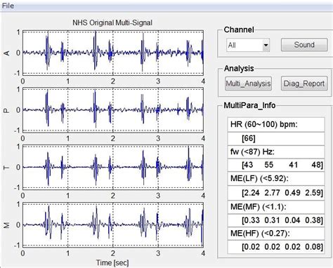 Gui Monitoring System Of Nhs Sample Download Scientific Diagram