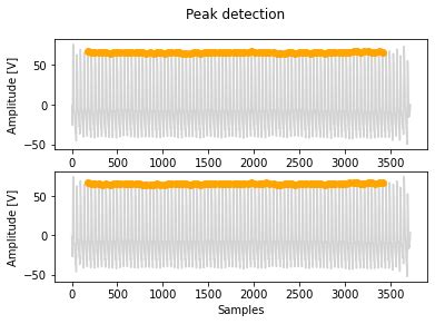 Beat Detection Signal Processing And Learning For Wearables