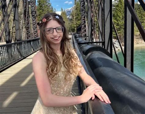 이 증후군으로 얼굴 기형된 10대 여성 유전자 돌연변이가 원인