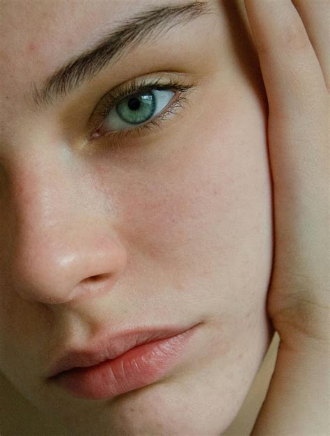 Podcast Katie Stewart Acne Nutritionist