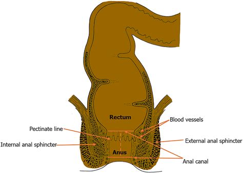 Anal Carcinoma Exploring The Epidemiology Risk Factors