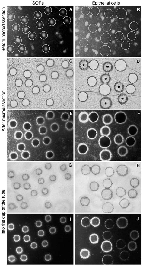 Laser Microdissection Laser Microdissection Of Sop Cells Left Column Download Scientific