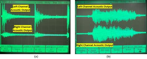 Real Time Synchronized Bilateral Ha Processing Through Cci Mobile With