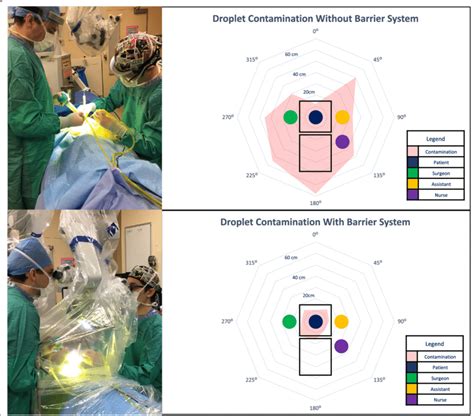 Droplet Contamination With And Without Barrier System Download